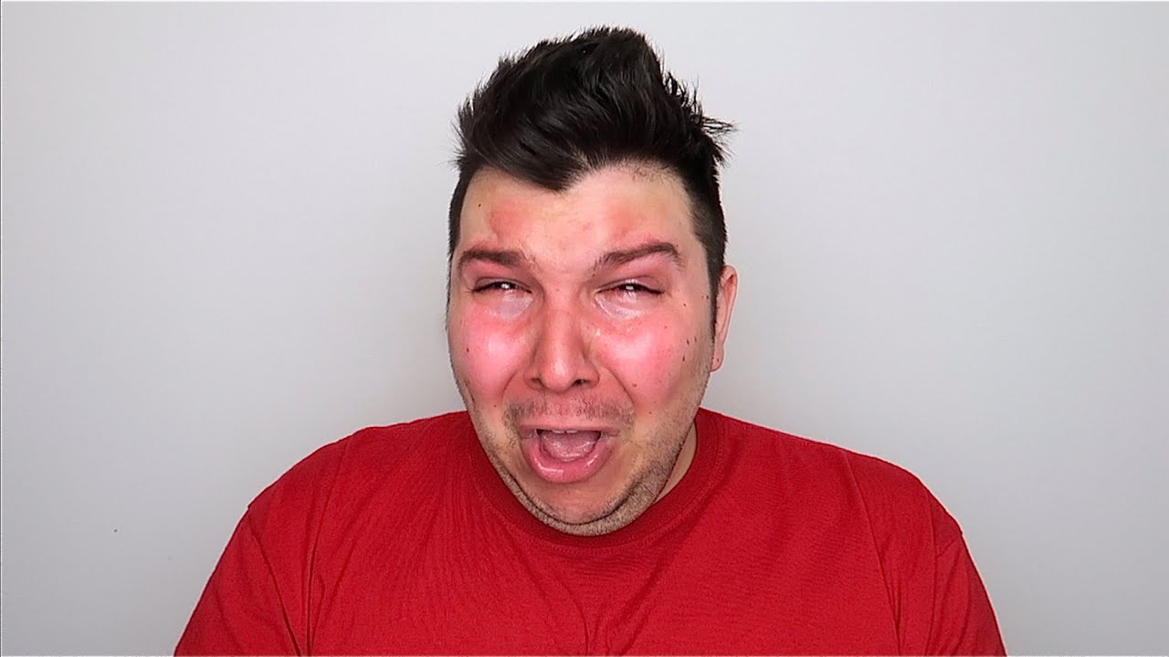 YouTuber-i i njohur ndan historinë e humbjes drastike në peshë ...