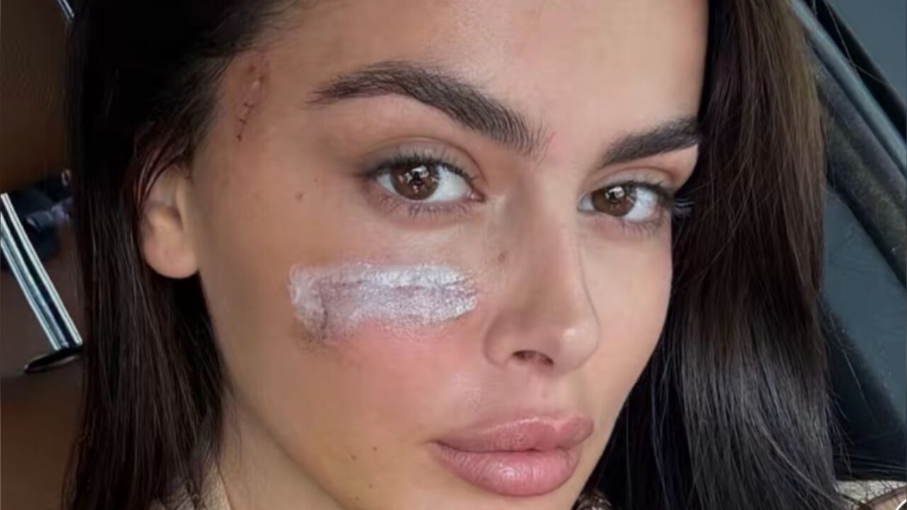 "Nuk kam hyrë në familje"/ Klea Prenga 'kërcënon' motrat Berisha pas ...